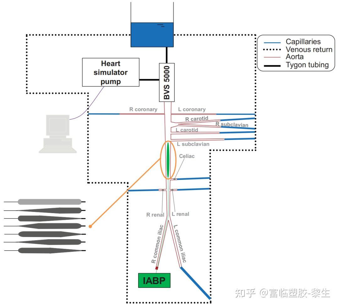 新形状的 IAB 可使半卧位患者的 IABP 治疗更加有效 - 知乎
