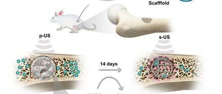 《Bioact. Mater.》：声学响应支架募集内源性干细胞用于骨缺损原位修复 - 知乎