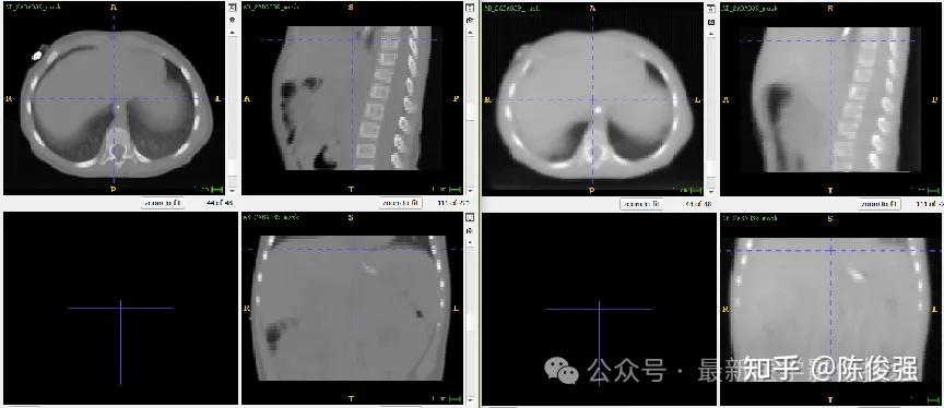 SynthRAD2025——用于放射治疗的计算机断层扫描生成挑战赛 - 知乎