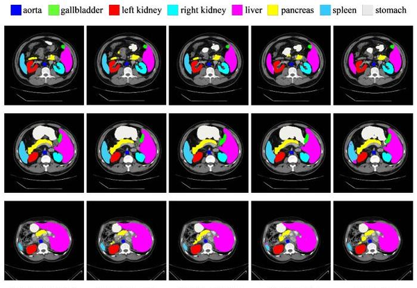 [CV - 图像分割]生物医学图像语义分割 Swin-Unet模型 - 知乎