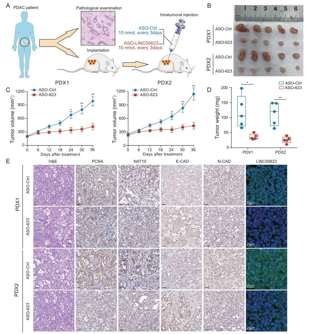 科研思路丨J Hematol Oncol（IF23+）丨外泌体lncRNA测序助力发现LINC00623促进胰腺癌进展的分子机制 - 知乎