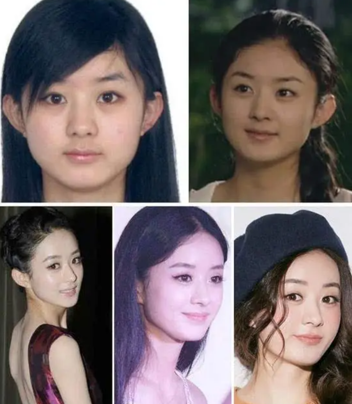 “整容成功”的这几位女星，你最喜欢谁？ - 知乎