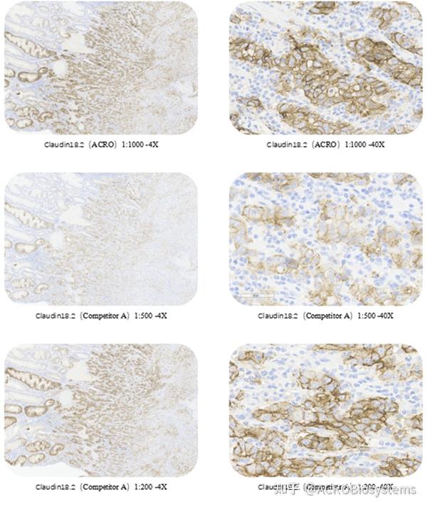 【IHC精准检测】——筛选获益人群关键抗体：Claudin 18.2 - 知乎