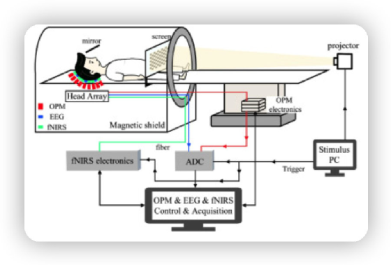 EEG-fNIRS、MEG-EEG-fNIRS多模态系统技术方法 - 知乎