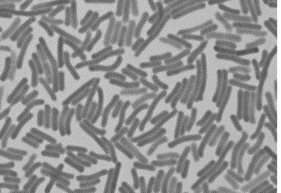 巨单胞菌属 Megamonas - 知乎