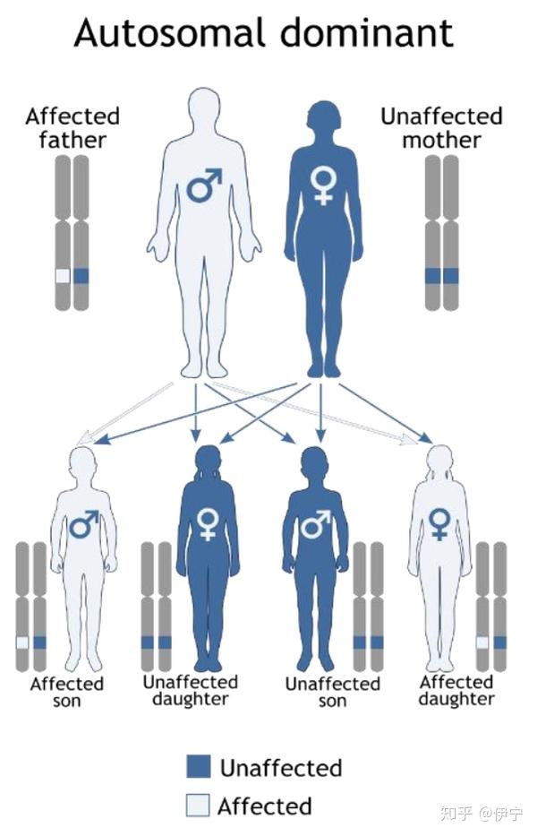 马凡综合征（Marfan syndrome），只要你活着，就有精彩！ - 知乎