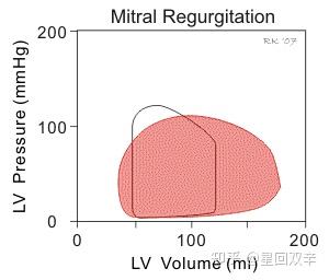 左心室压力-容积环（Left ventricular pressure-volume (PV) loops） - 知乎
