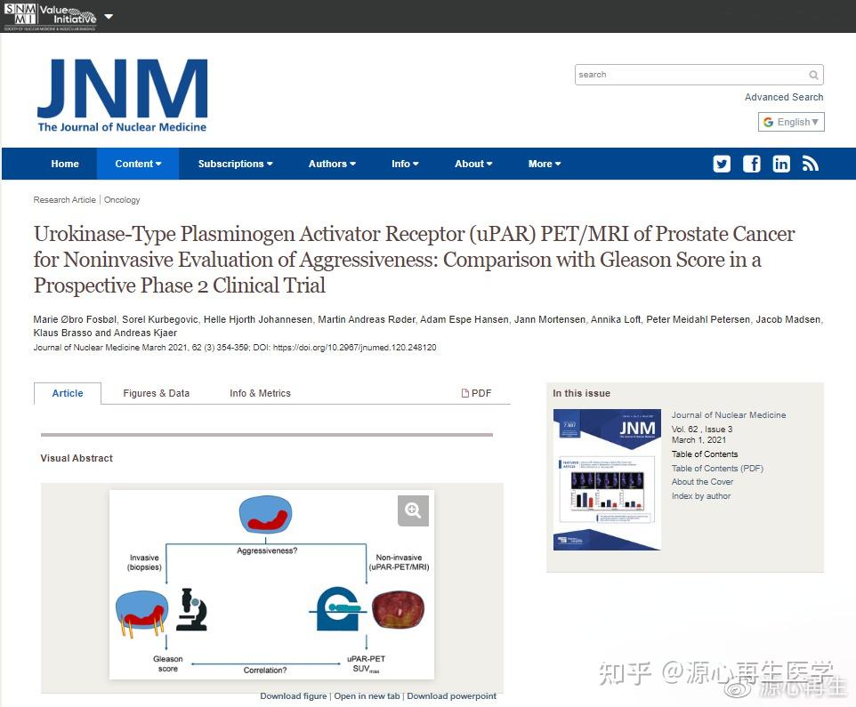 JNM丨精准治疗：靶向uPAR 68Ga-NOTA-AE105 PET/MRI技术助力前列腺癌诊断和治疗 - 知乎