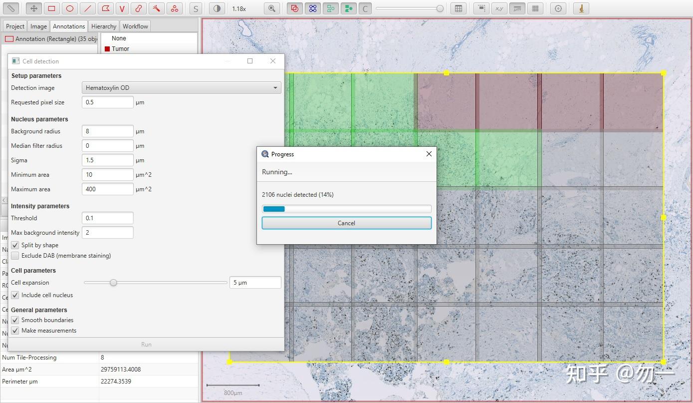 [数字病理]使用QuPath检测IHC阳性肿瘤细胞百分比 - 知乎