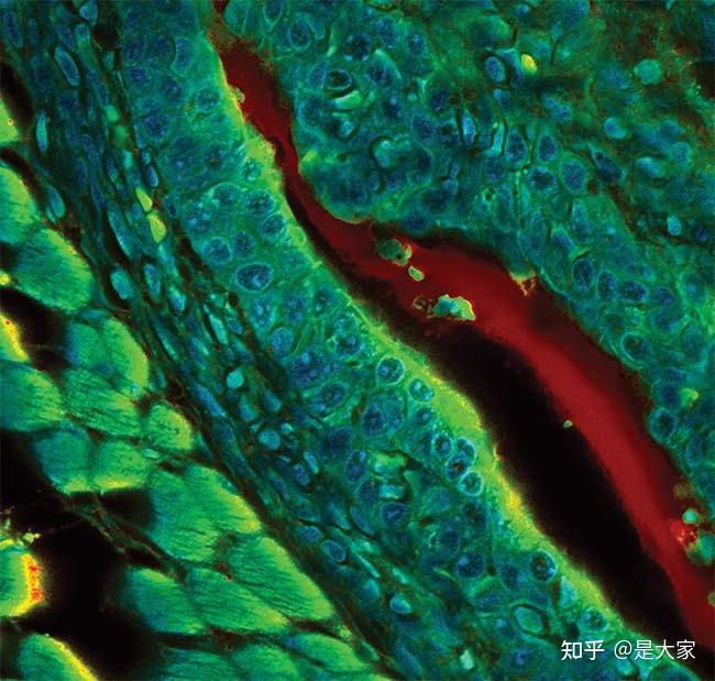 单光子雪崩二极管（SPAD） - 知乎