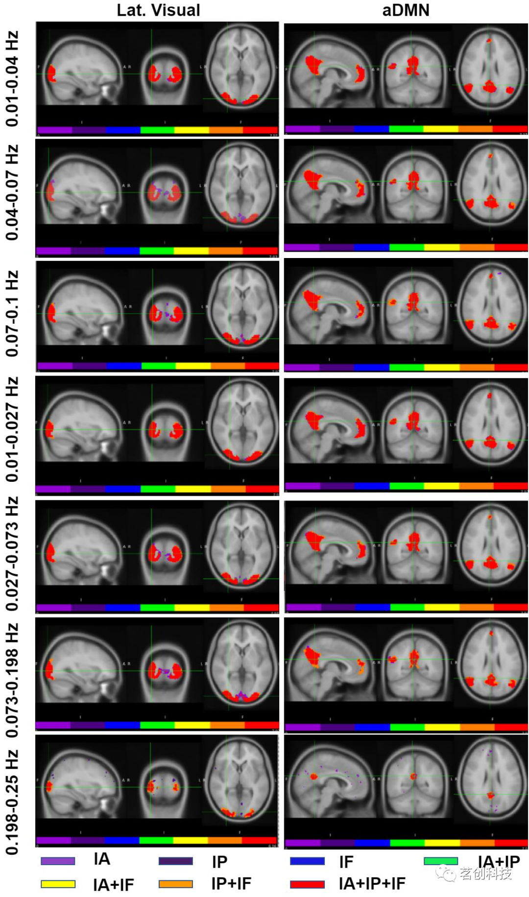 fMRI时间序列振幅和相位对功能连接分析的影响 - 知乎