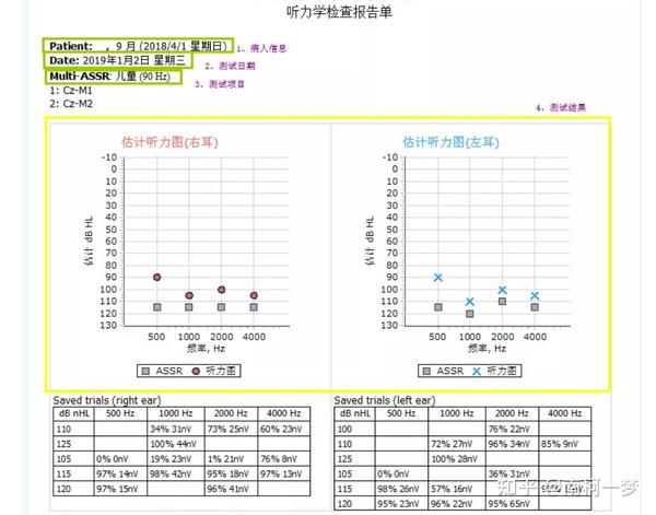 宝爸宝妈如何看懂电生理报告？（ASSR篇） - 知乎