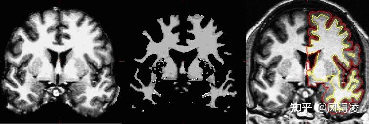 freesurfer下载安装，常用术语和recon-all命令 - 知乎