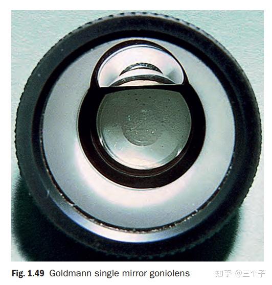 No.26,Indirect gonioscopy(2) - 知乎