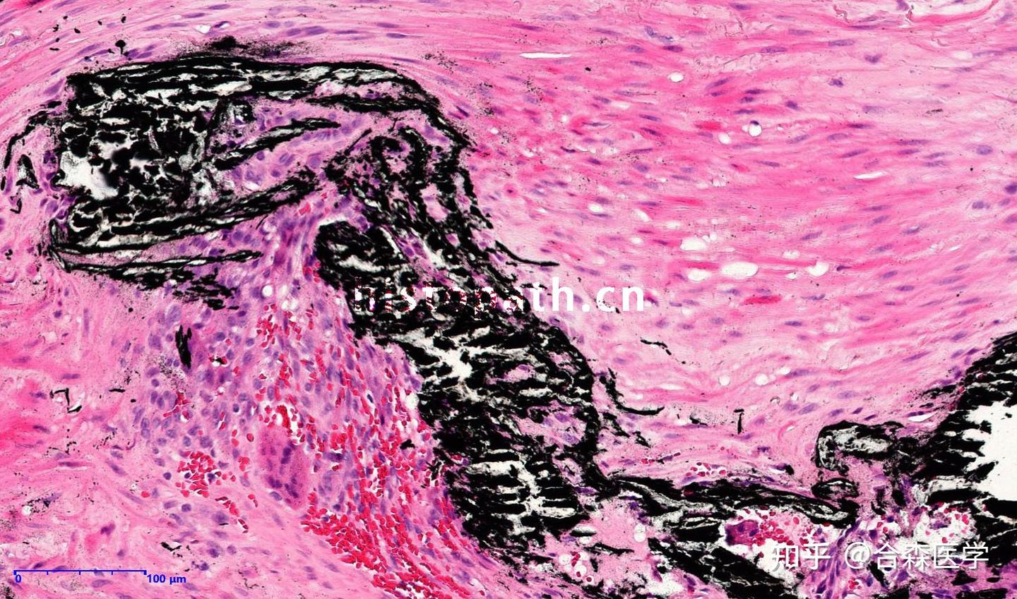 病理实验染色技术之--Von Kossa染色 - 知乎
