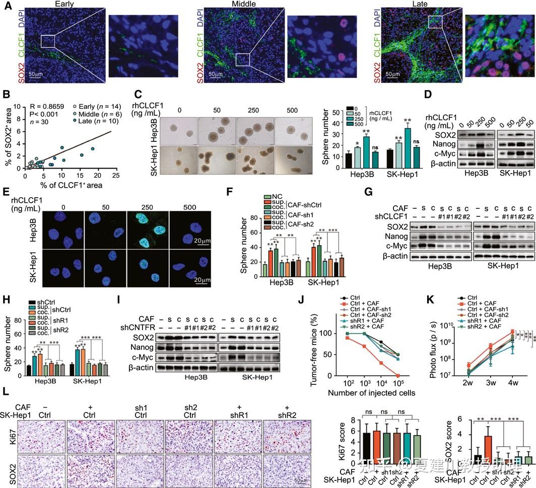 夏建川教授团队研究之：首次发现CAF细胞能促进肝癌免疫抑制微环境的形成！ - 知乎