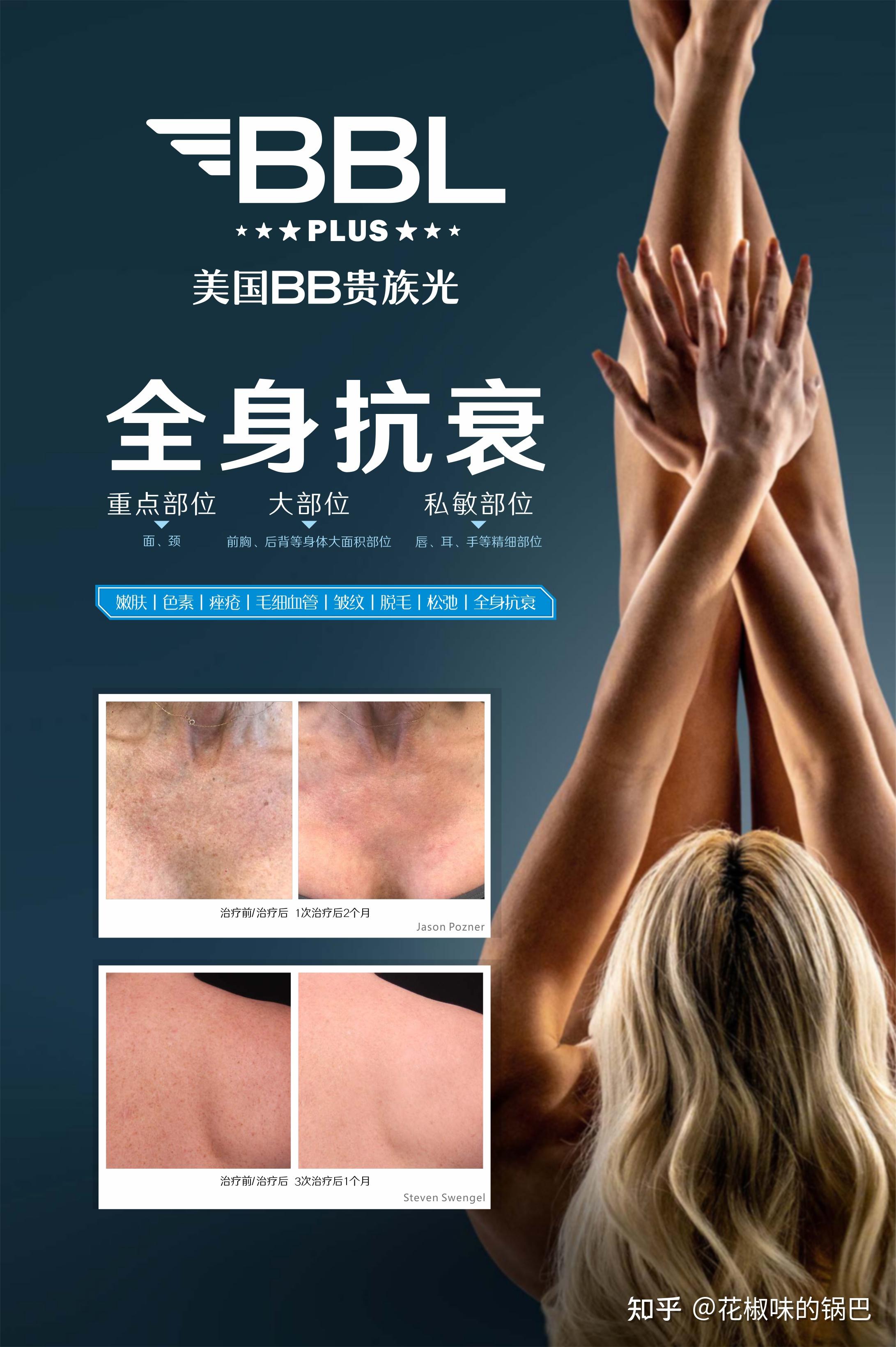 美国BBL PLUS贵族光 全身抗衰技术引领未来 - 知乎