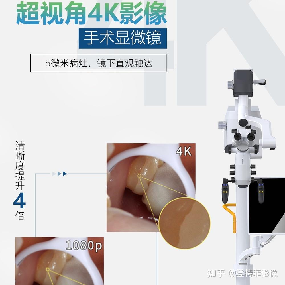 口腔显微镜怎么选？记住这5个要点不踩坑 - 知乎