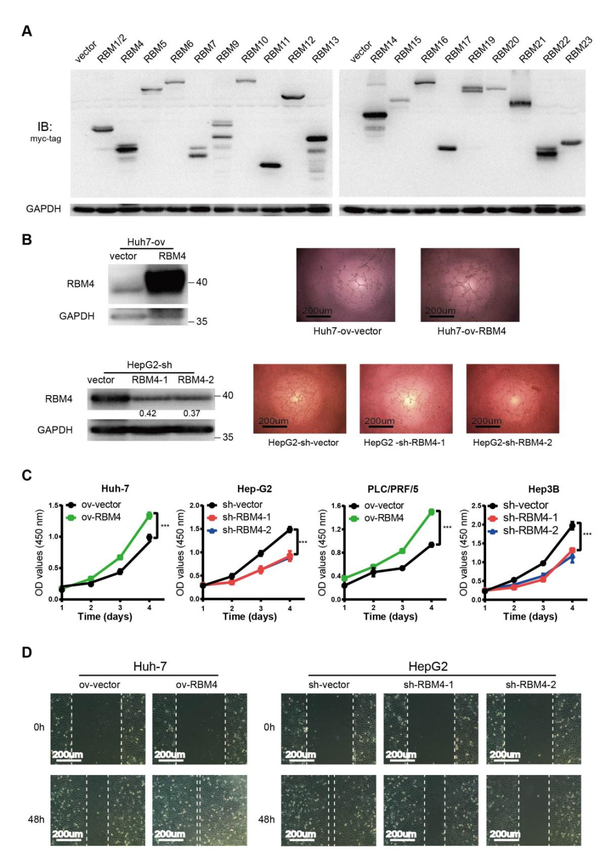 Pharmacol Res | 周国雄/叶军团队研究发现RBM4通过选择性激活VEGF-A的表达来促进肝癌中的血管生成 - 知乎