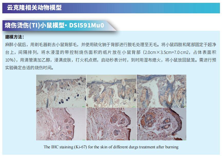 烧伤创伤的治疗突破：新策略帮助快速愈合 - 知乎