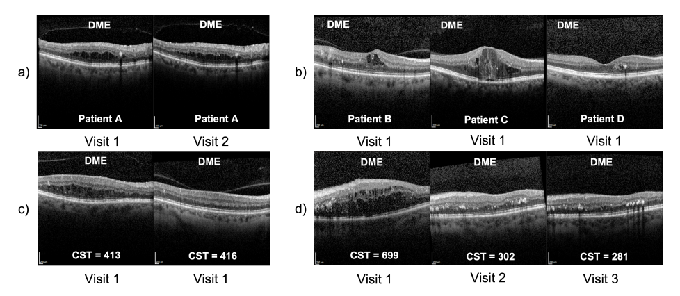 OLIVES 数据集介绍 - 知乎