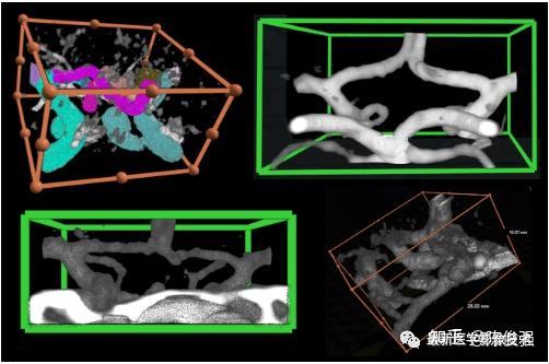 Top_Cow 2023——用于CTA和MRA的Willis环的拓扑解剖结构分割 - 知乎