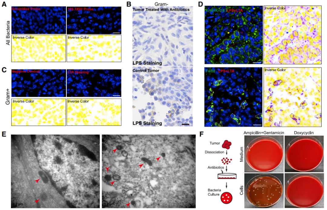 Cell：首次揭示肿瘤胞内菌在癌症转移过程中的作用 - 知乎