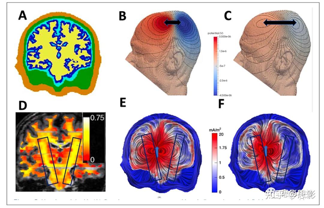 生物电磁学在人脑研究中的应用 - 知乎