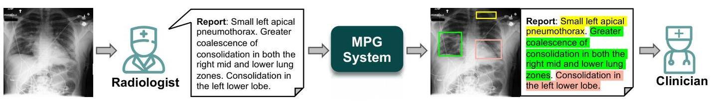Medical Phrase Grounding with Region-Phrase Context Contrastive ...