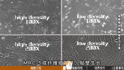 MRC-5细胞培养，人胚肺成纤维细胞培养攻略-丰晖生物 - 知乎