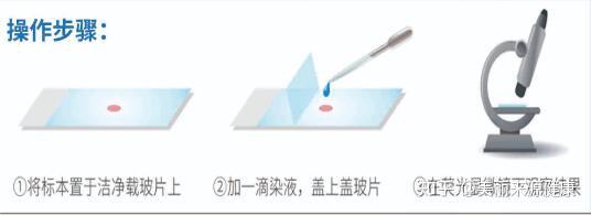 医用妇科真菌染色液：真菌直接涂片镜检，精准预防女性私处真菌感染！ - 知乎