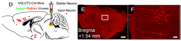 【客户文章】空军军医大学李云庆教授、董玉琳副教授团队在dmPFC-vlPAG投射神经元参与疼痛维持阈值和抗焦虑行为研究取得新进展 - 知乎