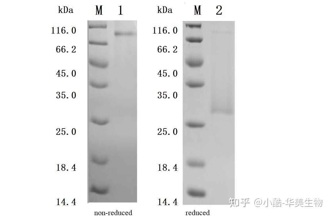 靶向CD70的免疫治疗新突破：从疾病机制到iPSC-CAR-NK疗法的临床前景 - 知乎