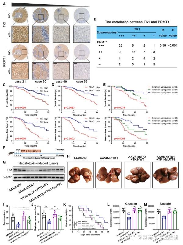 IF：29！国自然热点代谢重编程再发高分！南京医科大学王学浩/武汉大学张鹏团队揭示TK1在肝细胞癌中重要作用 - 知乎