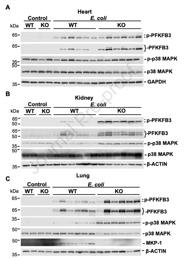 JBC丨p38 MAPK 和 MKP-1 在脓毒症期间通过双功能糖酵解调节剂 PFKFB3 控制糖酵解程序 - 知乎
