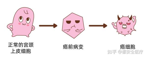 打了hpv疫苗还会得宫颈癌? 知乎