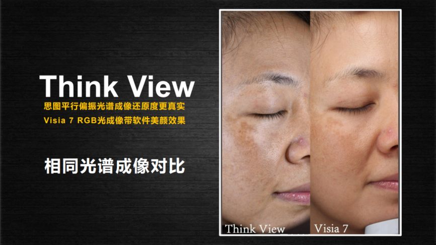 台湾ThinkView思图皮肤影像分析仪丨6光谱，让皮肤检测更精确 - 知乎