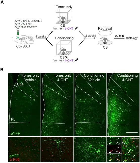 Neuron：奖励可以克服恐惧？还得前额叶抑制性中间神经元说了算 - 知乎