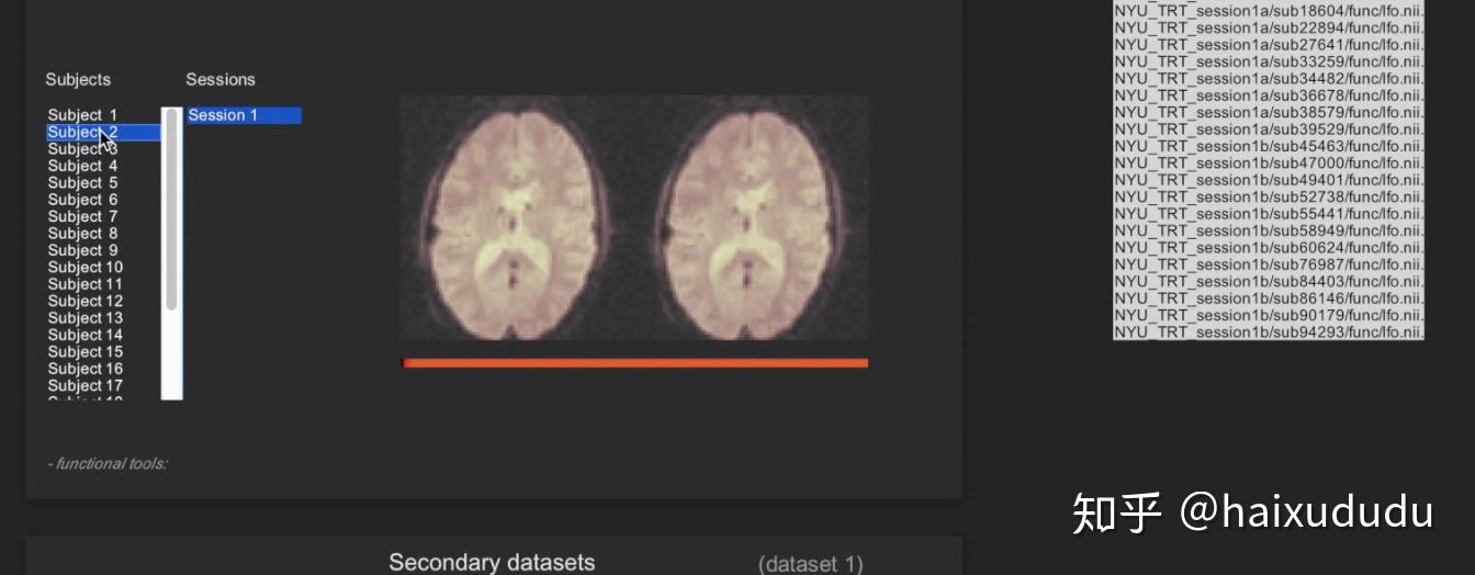 CONN使用总结1 (resting-state fMRI) - 知乎
