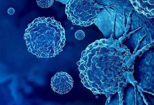 Miplyffa 获FDA批准用于治疗 C 型尼曼匹克病 - 知乎