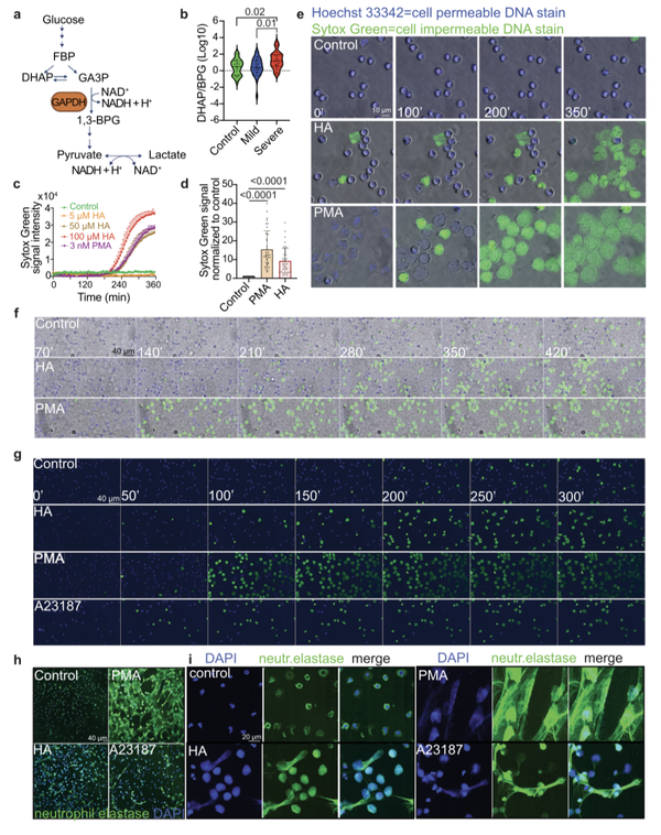 Nature子刊丨严重 COVID-19 中的中性粒细胞代谢组学揭示 GAPDH 是中性粒细胞胞外陷阱形成的抑制剂 - 知乎
