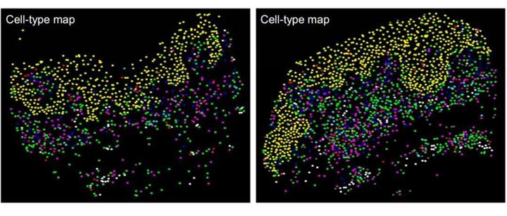 SpatialScore新型空间生物标志预测CTCL免疫治疗效果 - 知乎