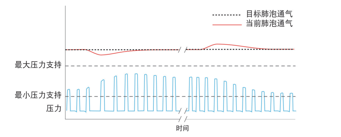 5分钟带你认识瑞思迈呼吸机——Lumis150 VPAP ST - 知乎