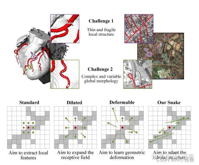 Yolov8优化：动态蛇形卷积（Dynamic Snake Convolution），实现暴力涨点 | ICCV2023 - 知乎