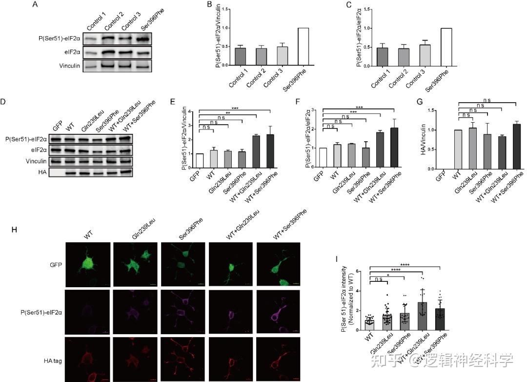 Ann Neurol︱福建医科大学附院陈万金/北京大学三院樊东升团队揭示SerRS基因杂合突变导致腓骨肌萎缩症 - 知乎