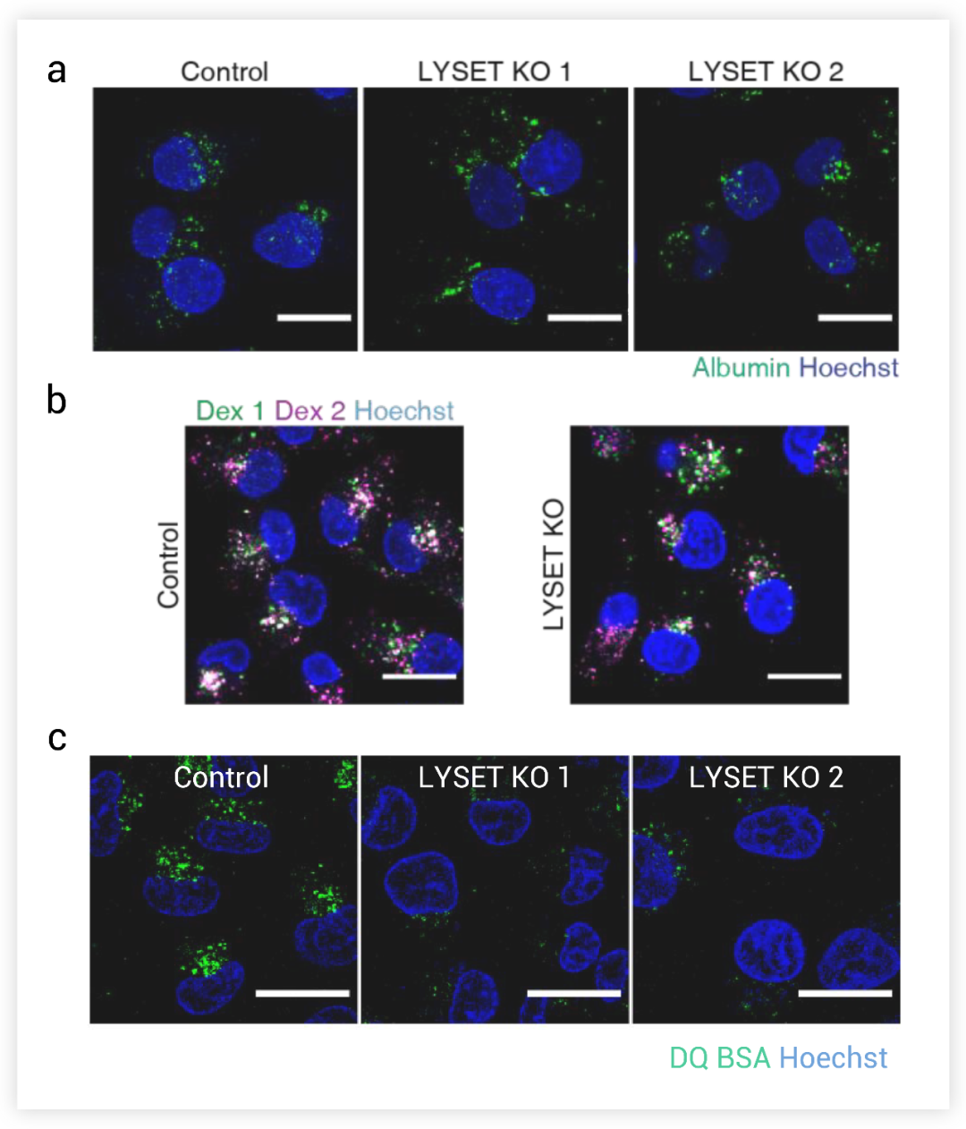 Science 背靠背 | 溶酶体酶转运因子 LYSET - MedChemExpress - 知乎