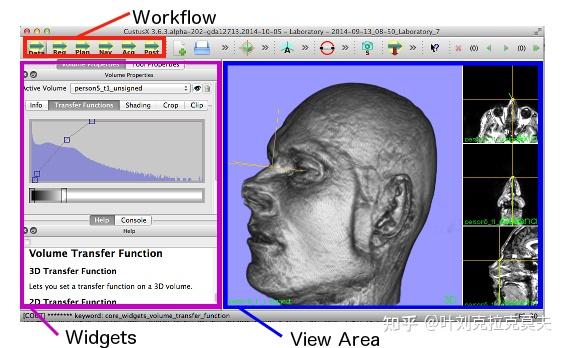 开源科学工程技术软件介绍65 – 用于图像引导治疗的研究平台CustusX - 知乎