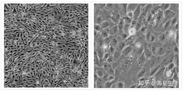 Bend.3小鼠脑微血管内皮细胞培养要点 - 知乎
