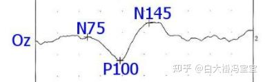 视觉诱发电位检查 - 知乎