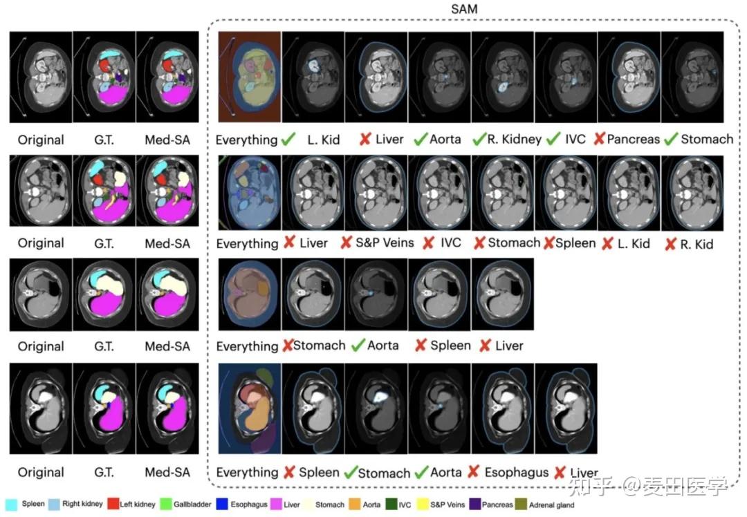 《Medical SAM适配器：将分割一切模型适配于医学图像分割》|文献速递-深度学习医疗AI最新文献 - 知乎